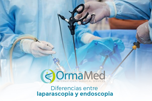 Diferencias entre laparoscopia y endoscopia - Orma Med