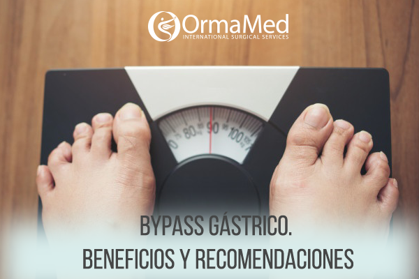 Bypass Gástrico. Beneficios y recomendaciones - Orma Med